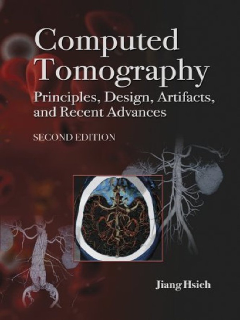 Computed Tomography Principles, Design, Artifacts, and Recent Advances ...