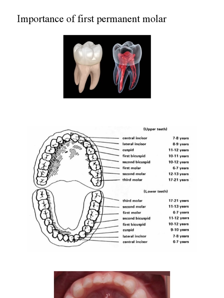 Significance of First Permanent Molar | PDF | Tooth | Clinical Medicine