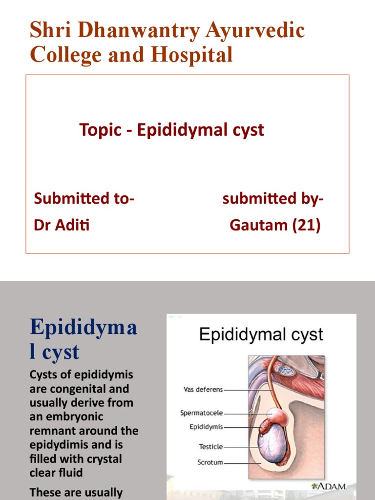 An In-Depth Look at Epididymal Cysts: Causes, Symptoms, Diagnosis and ...