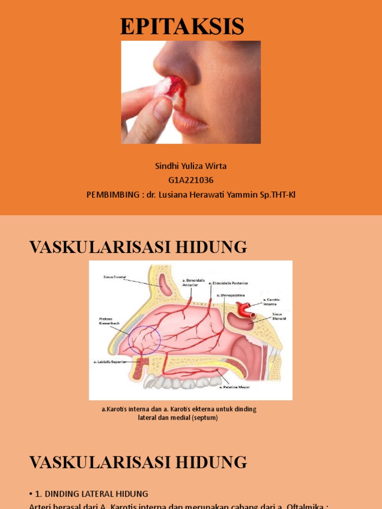 Panduan Epistaksis untuk Medis | PDF | Sains & Matematika