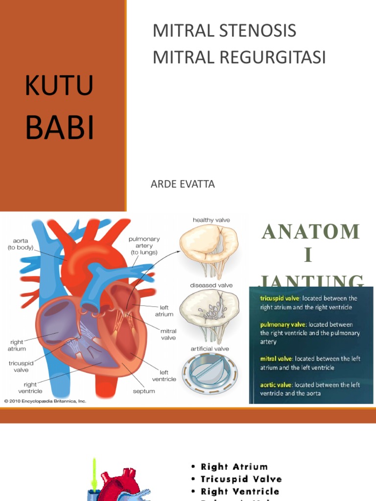 Mitral Stenosis Dan Mitral Regurgitasi | PDF | Sains & Matematika