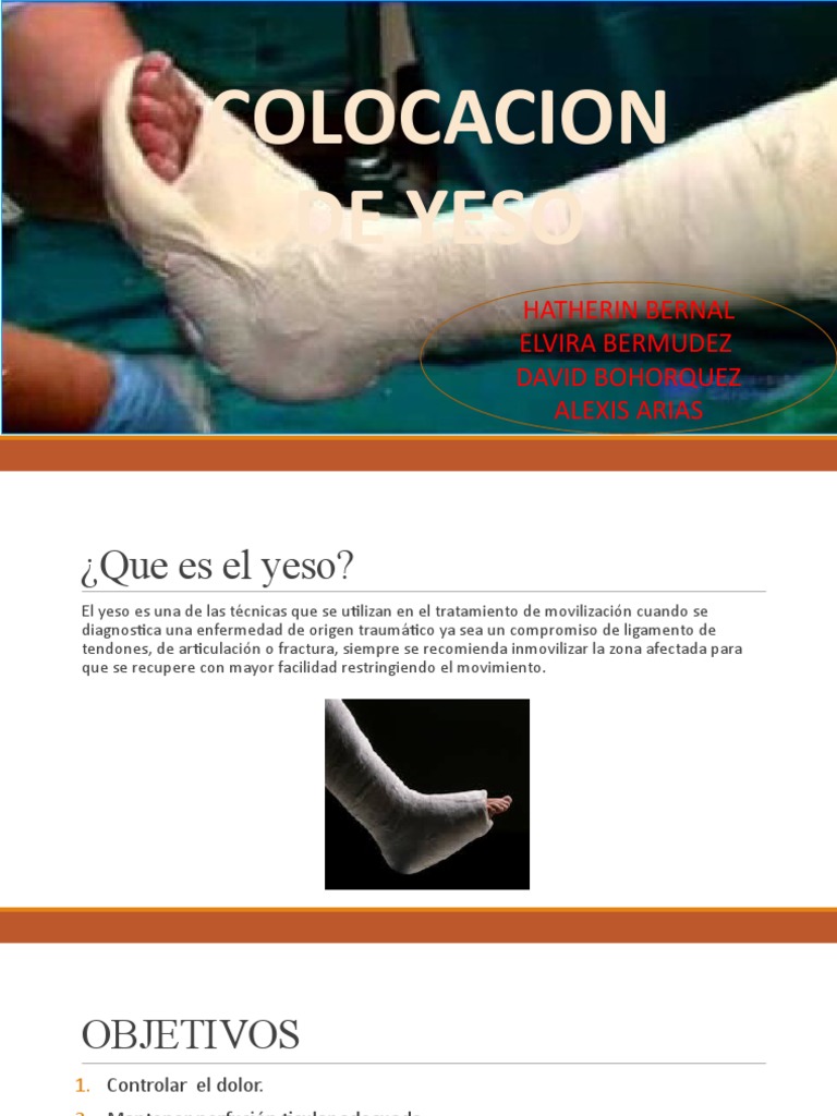 Colocación y cuidado del yeso | PDF | Enfermedades y trastornos ...