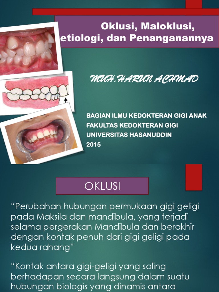 Perkembangan Oklusi dan Jenis Maloklusi pada Anak | PDF