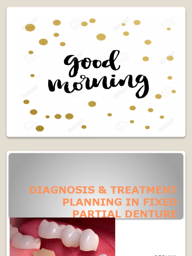 Diagnosis and Treatment Plan in FPD - PPTX New | PDF | Dental Implant ...