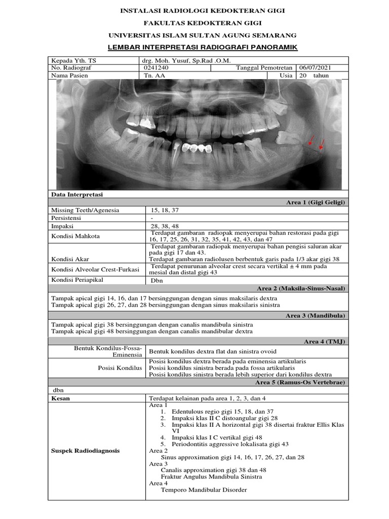 Lembar Radiografi Panoramik Laporan Kasus Kompleks Fraktur | PDF