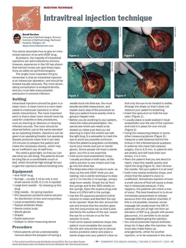 Intravitreal Injection Technique: Setting | PDF | Injection (Medicine ...