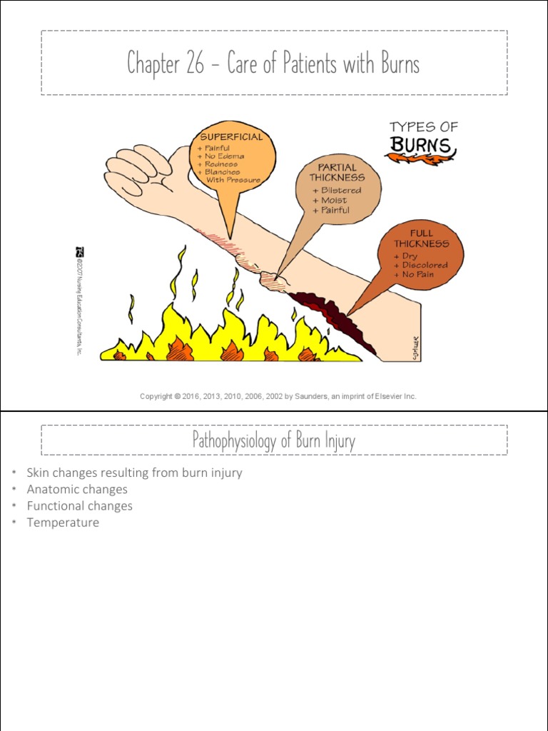 Iggy - Chapter 26 - Burns - PP | PDF | Kidney | Urine