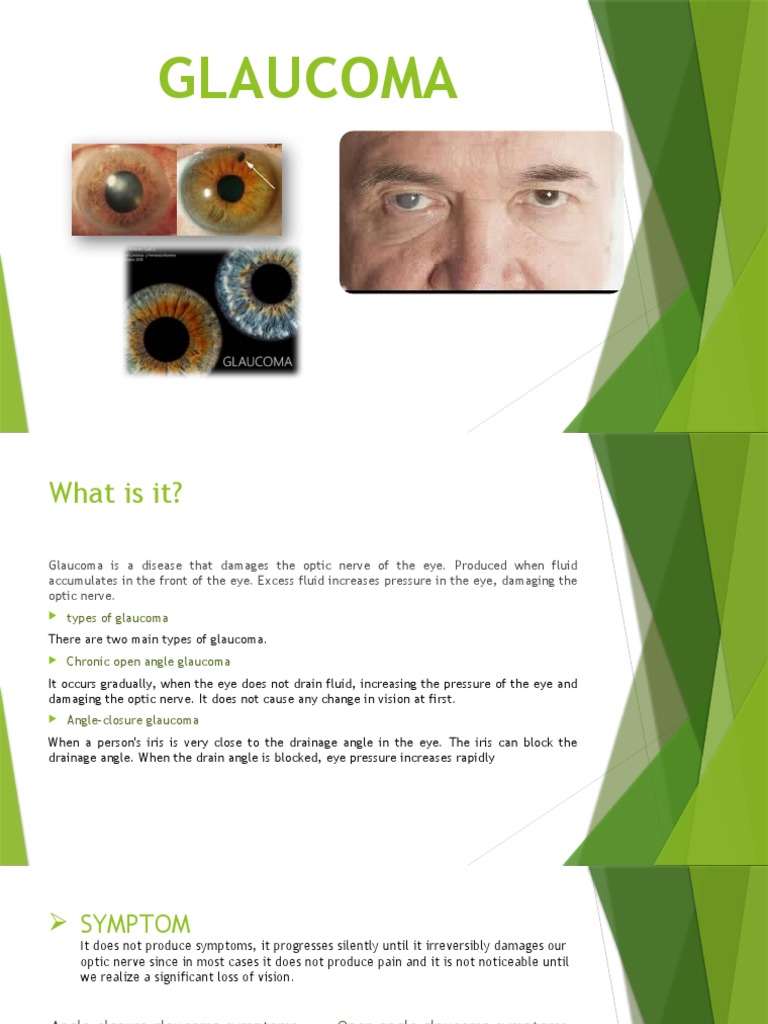Glaucoma Pdf Glaucoma Medicine