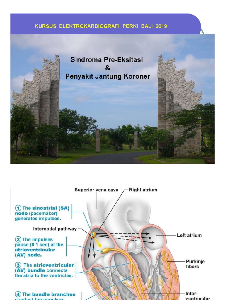 KURSUS ELEKTROKARDIOGRAFI PERKI BALI 2019: SINDROMA PRE-EKSISTENSI DAN ...