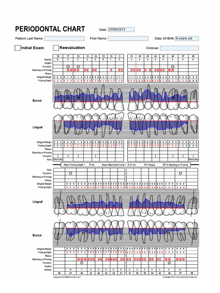 Periodontal Chart - Type1-8 | PDF