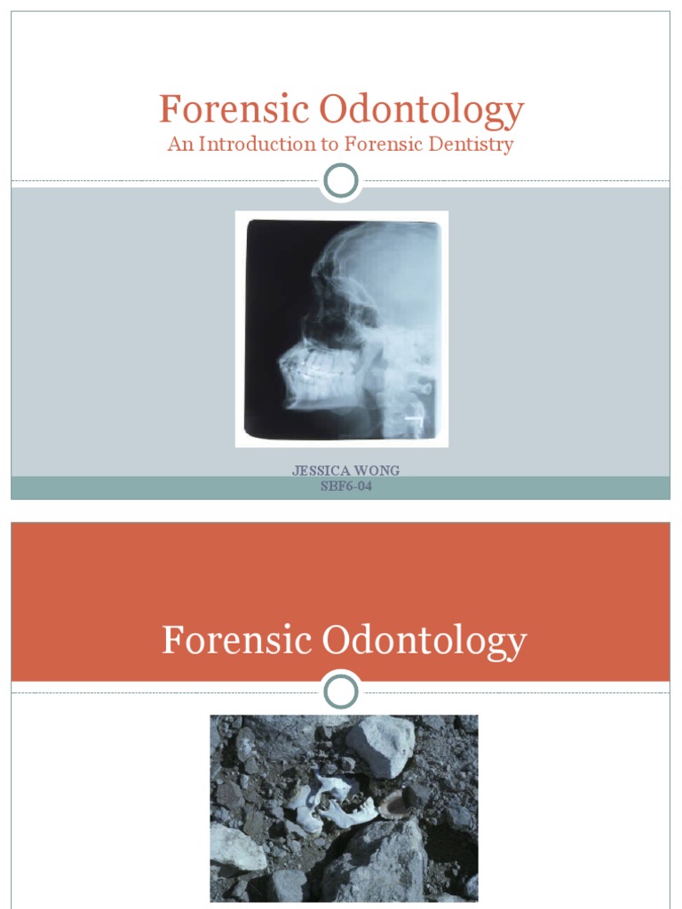 Forensic Odontology: An Introduction To Forensic Dentistry | PDF ...