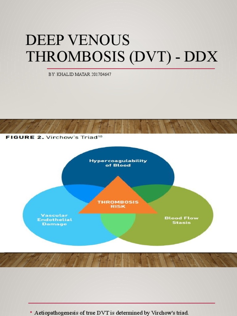 Deep Venous Thrombosis (DVT) - DDX | PDF