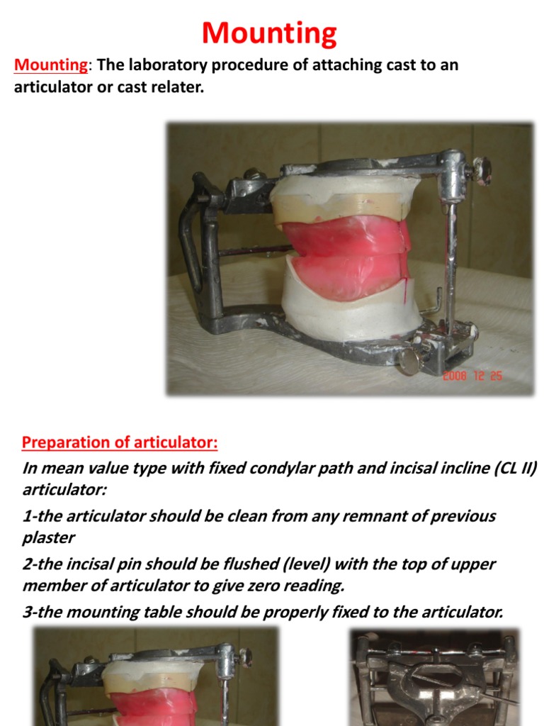 Mounting:: The Laboratory Procedure of Attaching Cast To An | PDF ...