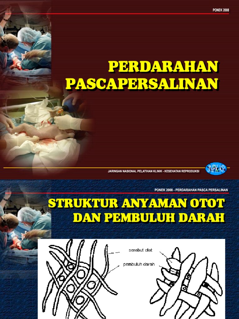 11C Perdarahan Pascapersalinan-SR | PDF