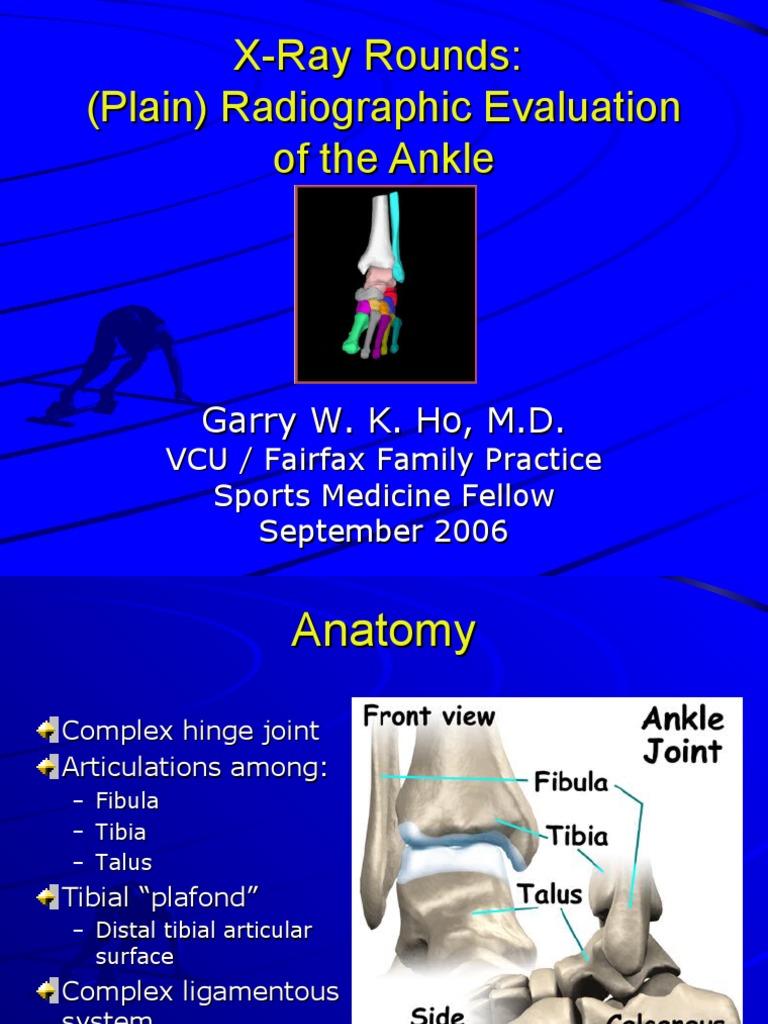 X-Ray Rounds: (Plain) Radiographic Evaluation of The Ankle | PDF ...