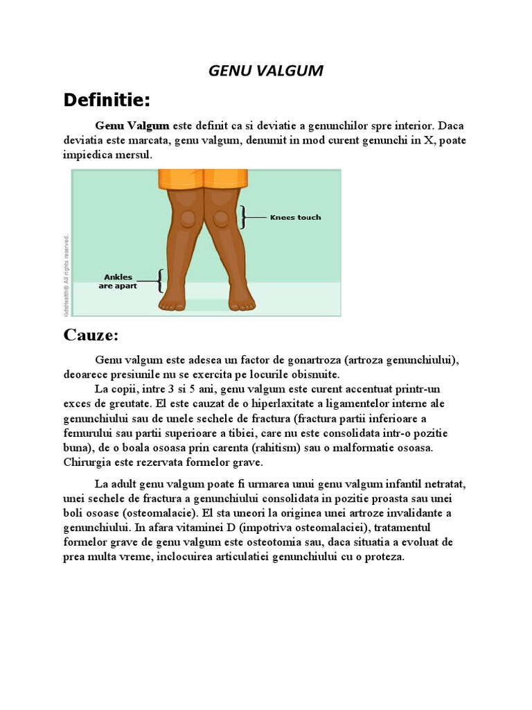 Genu Valgum: Cauze și Tratament | PDF
