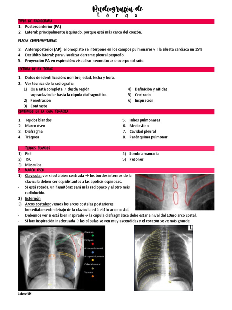 Radiografía de Tórax Normal | PDF | Pulmón | Tórax