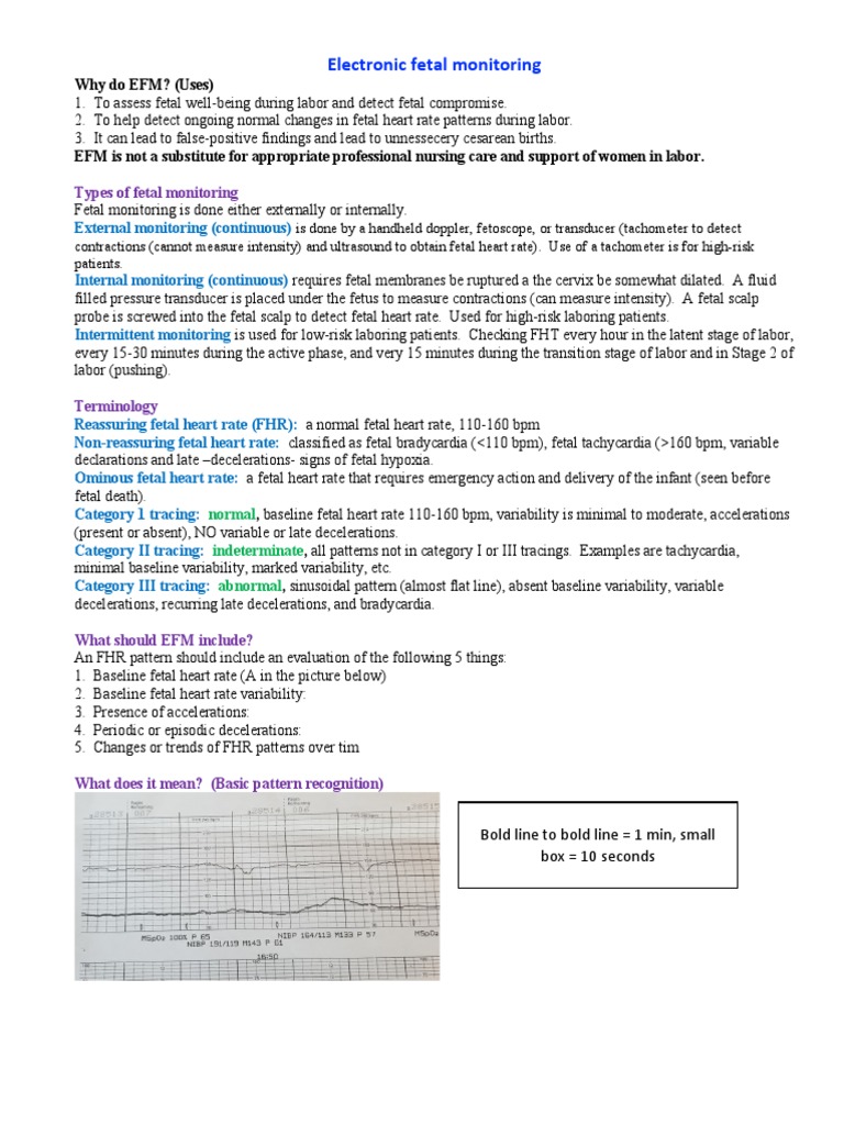 Electronic Fetal Monitoring | PDF | Childbirth | Heart Rate