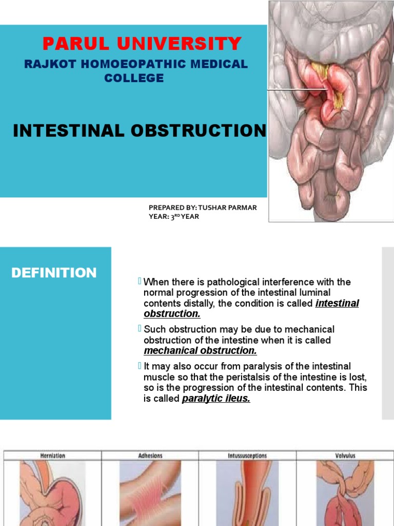 Intestinal Obstruction | PDF | Gastrointestinal Tract | Clinical Medicine