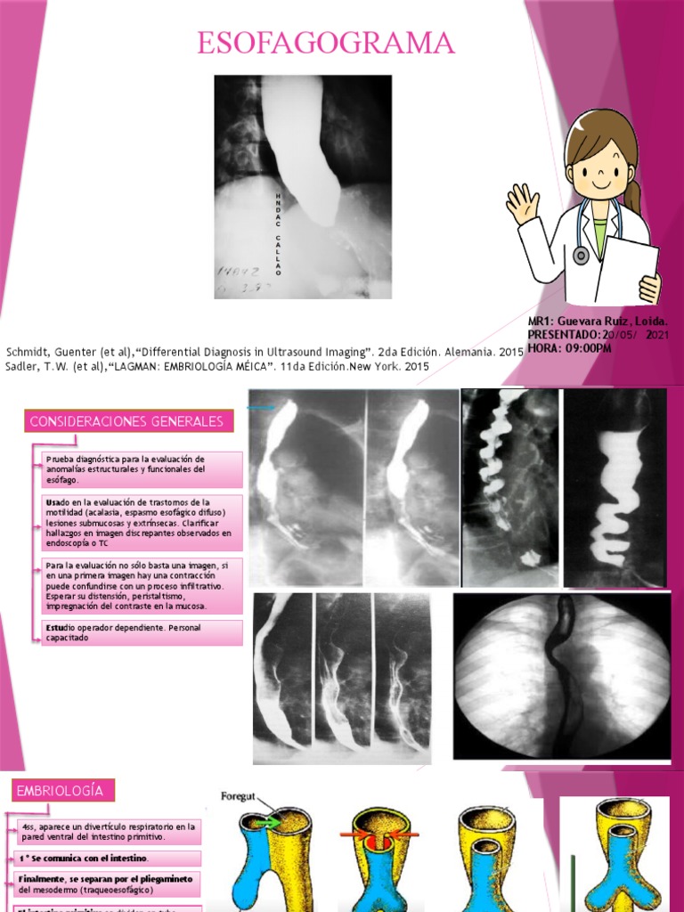 ESOFAGOGRAMA (Autoguardado) | PDF | Estómago | Gastroenterología