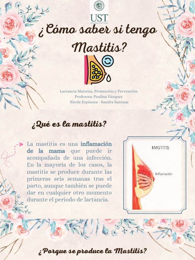 ¿Cómo Saber Si Tengo Mastitis | PDF | Pecho | Epidemiología