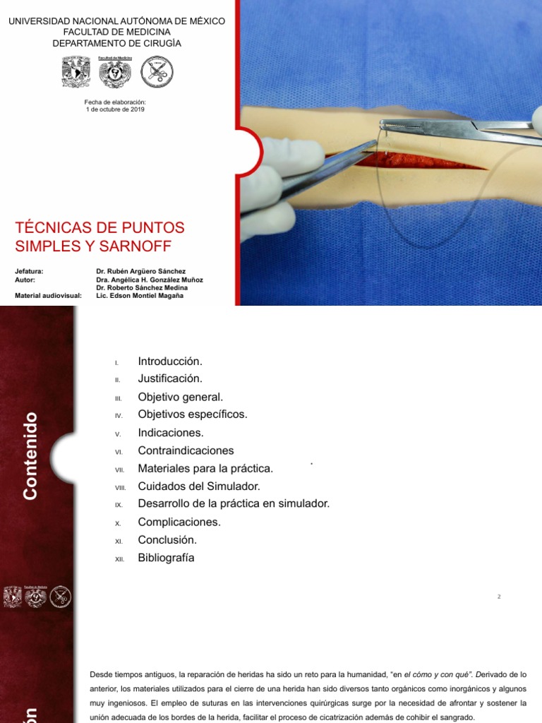 VF Técnica de Puntos Simples Sarnoff | PDF | Herida | Cirugía