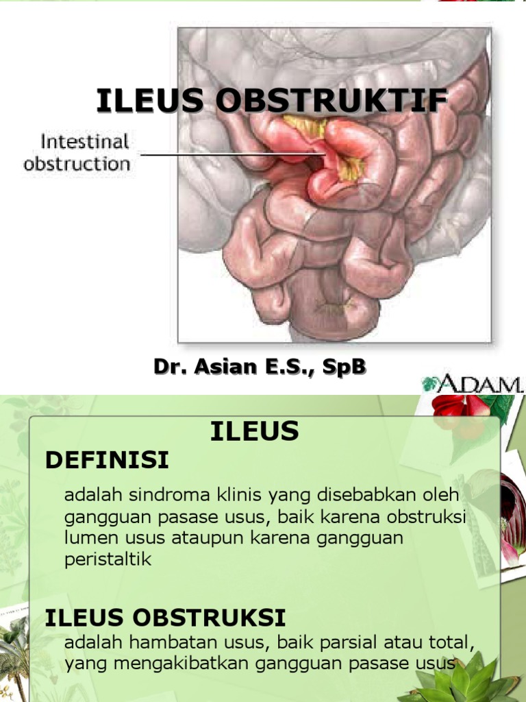 Ileus Obstruksi Oke | PDF
