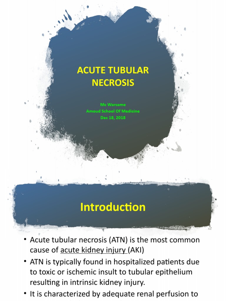 Acute Tubular Necrosis Overview | PDF | Science & Mathematics