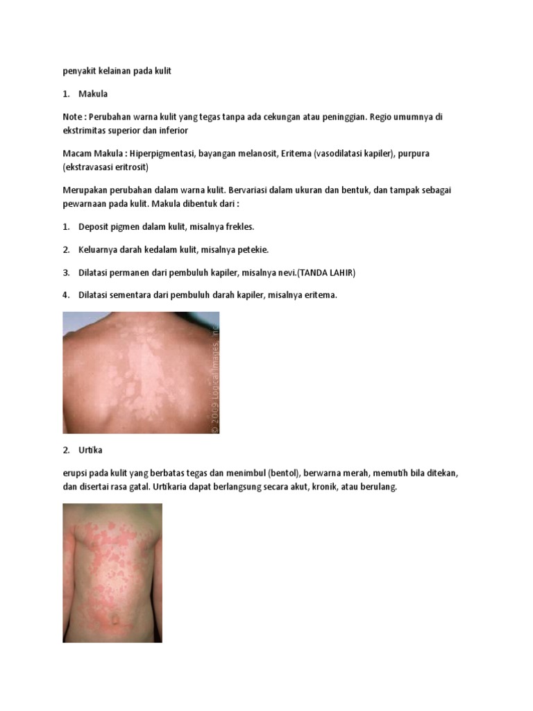 Penyakit Kelainan Pada Kulit+gambar | PDF
