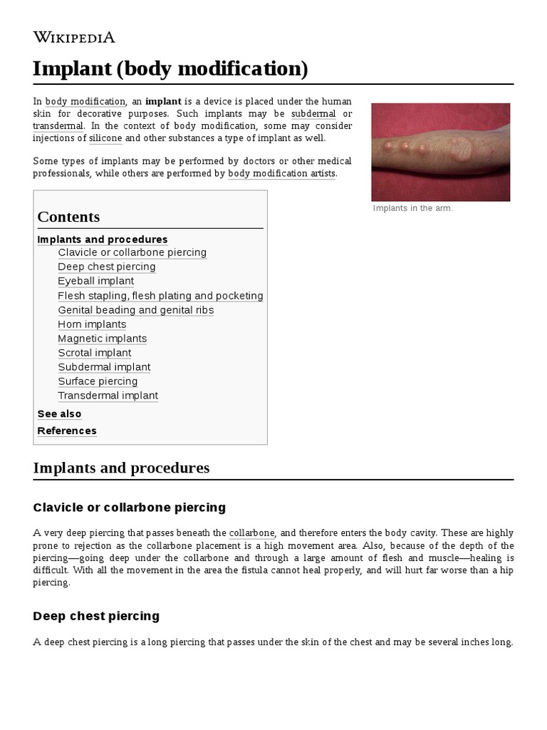Implant (Body Modification) | PDF | Human Appearance | Human Body