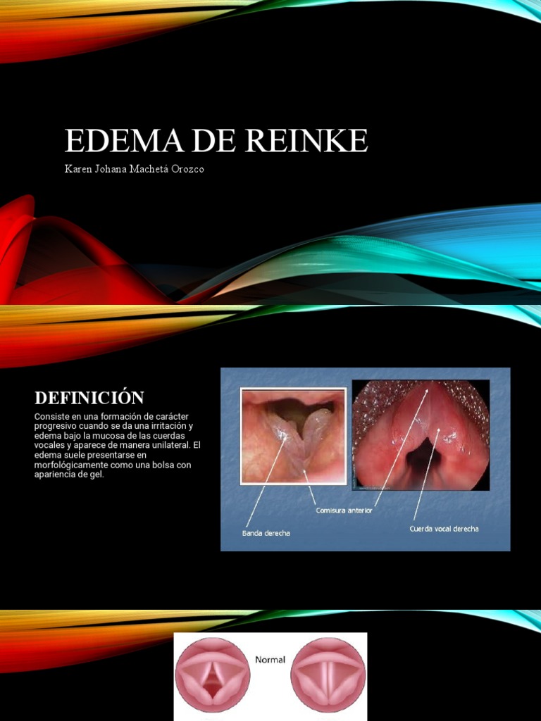 Edema de Reinke | PDF