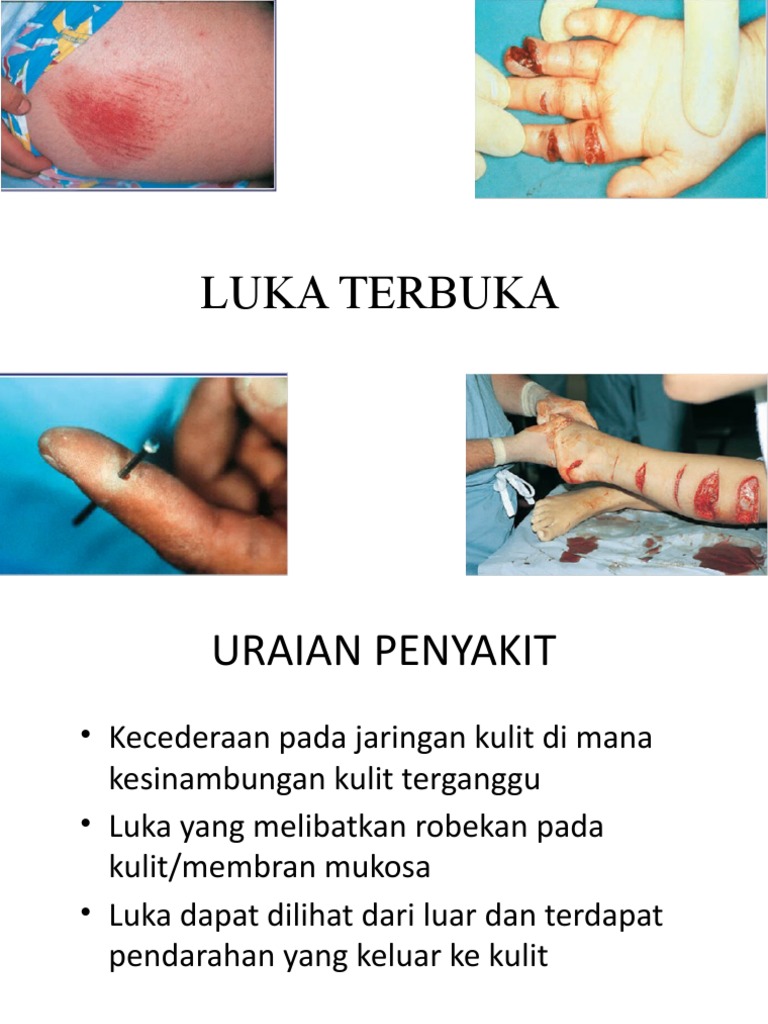 Luka Terbuka | PDF