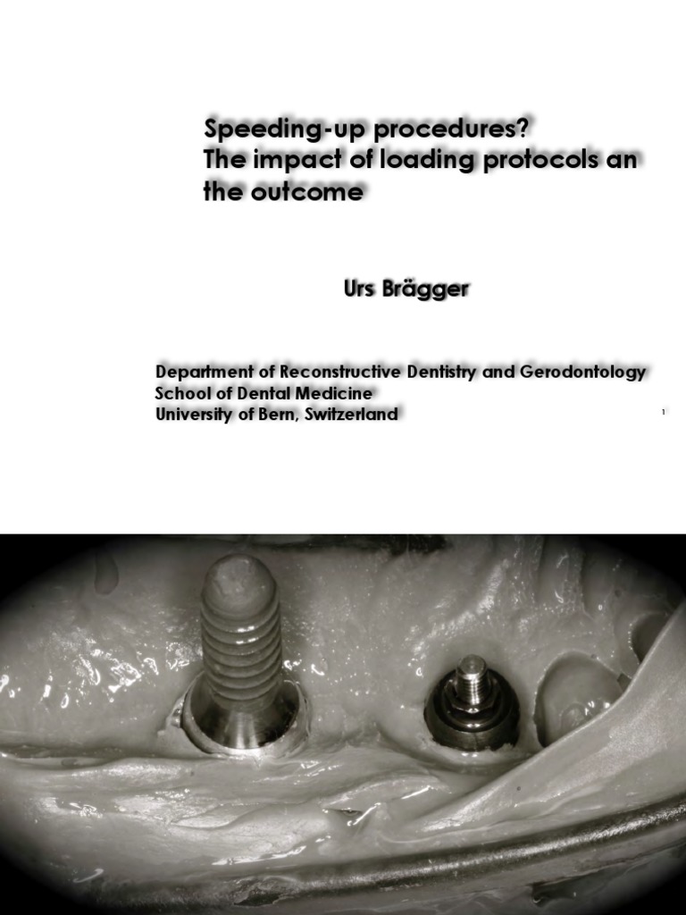 Implant Loading Protocols Overview | PDF | Dental Implant | Randomized ...
