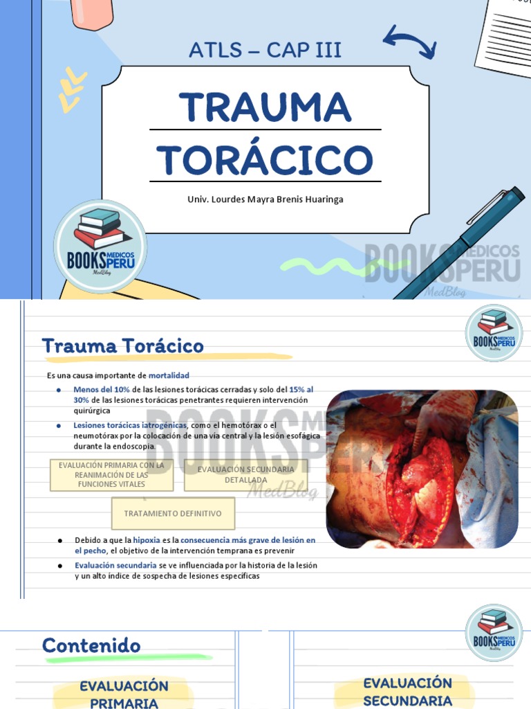 Trauma Torácico | PDF | Reanimación cardiopulmonar | Lesión