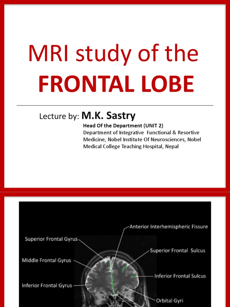 MRI Study of the Frontal Lobe | PDF | Science & Mathematics | Computers