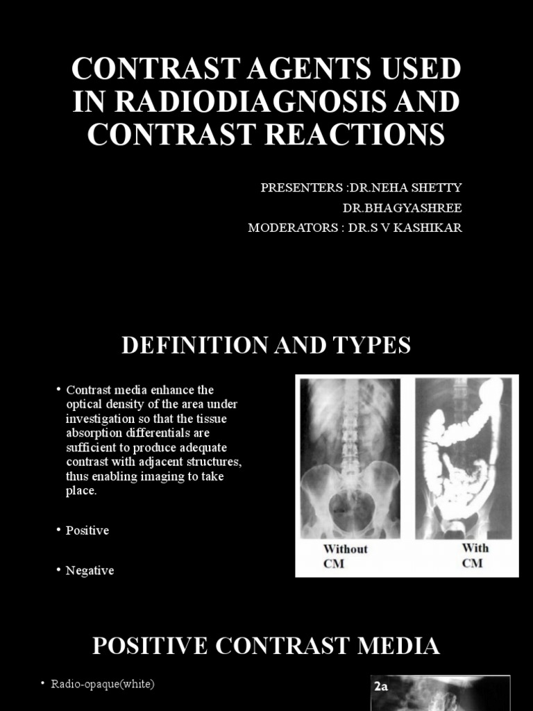 Contrast PPT 2 | PDF | Magnetic Resonance Imaging | Medical Specialties