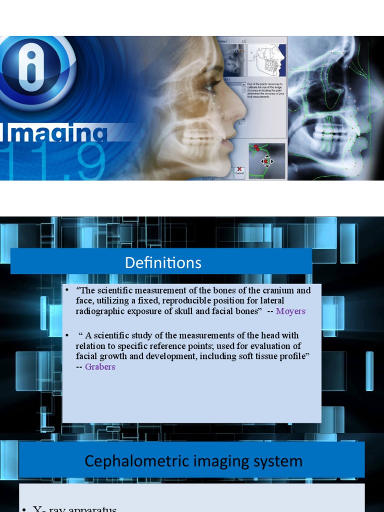 Planum Sphenoidale Lateral Ceph