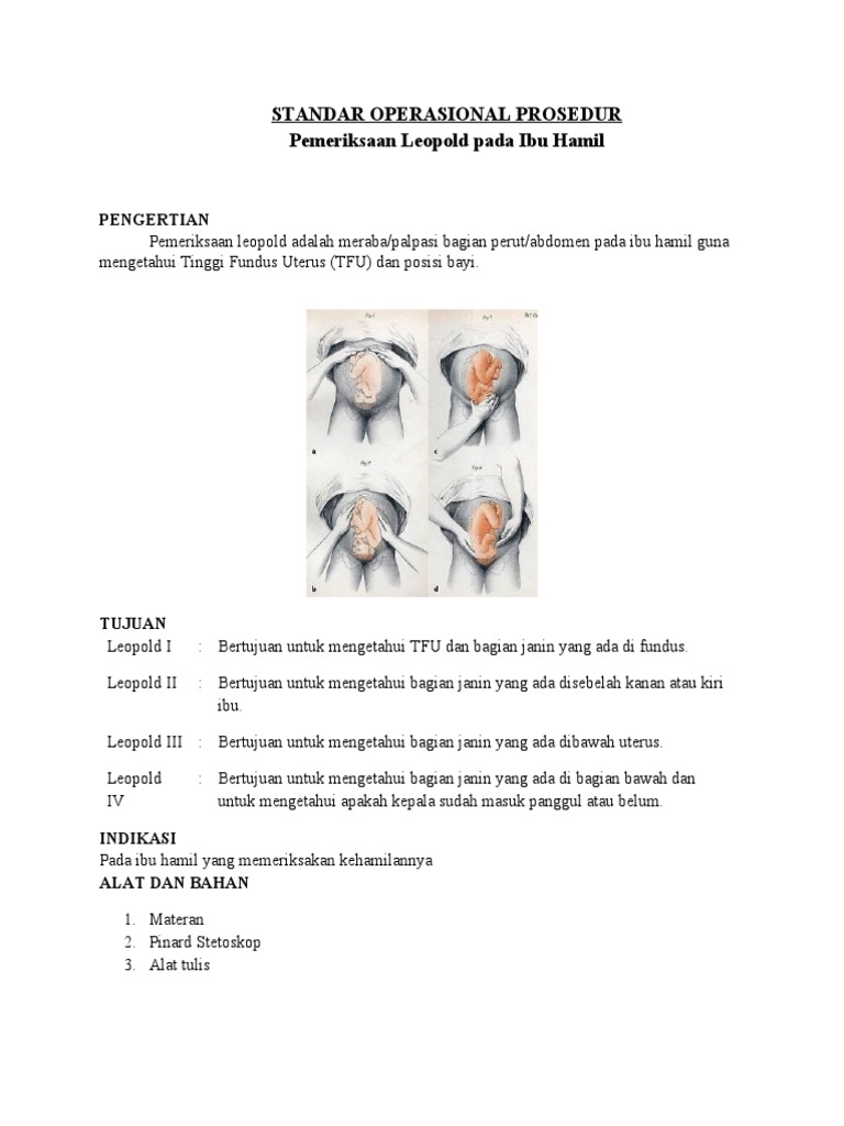 SOP Pemeriksaan Leopold Pada Ibu Hamil Diane Natalia Poli | PDF