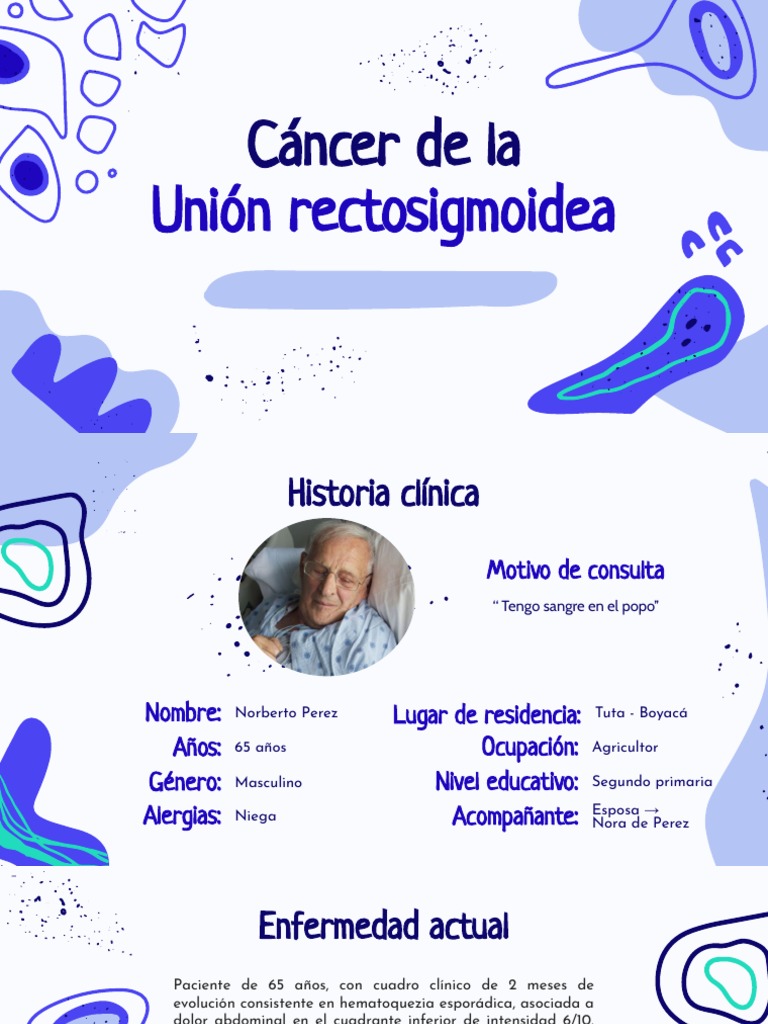Cáncer de La Unión Rectosigmoidea | PDF | Cáncer | Cáncer colonrectal