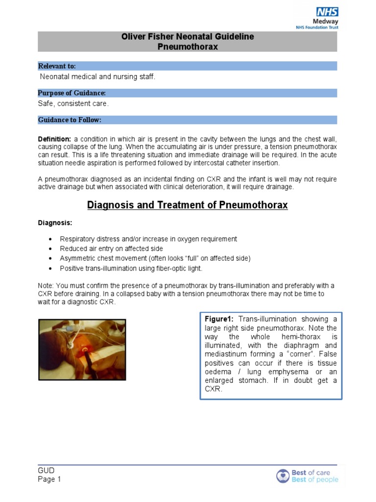 Pneumothorax Guideline | PDF | Medicine | Medical Specialties