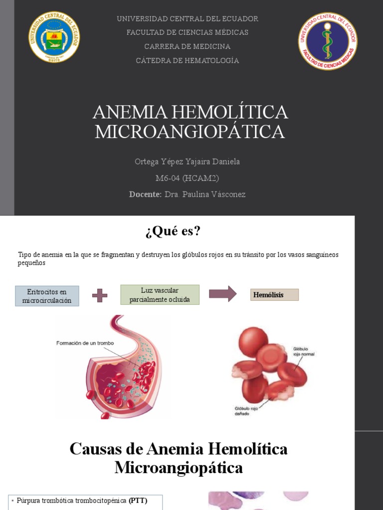 Anemia Hemolitica Microangiopatica | PDF | Coagulación | Plaqueta
