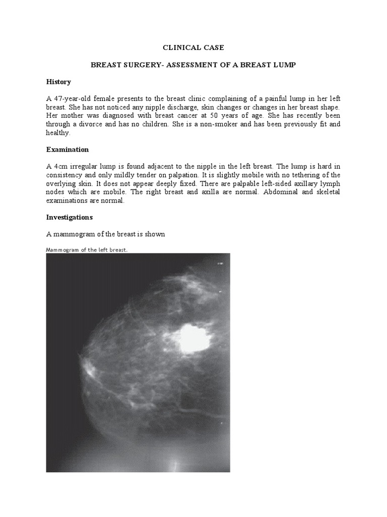 Breast Surgery - Assessment of A Breast Lump | PDF | Breast Cancer ...