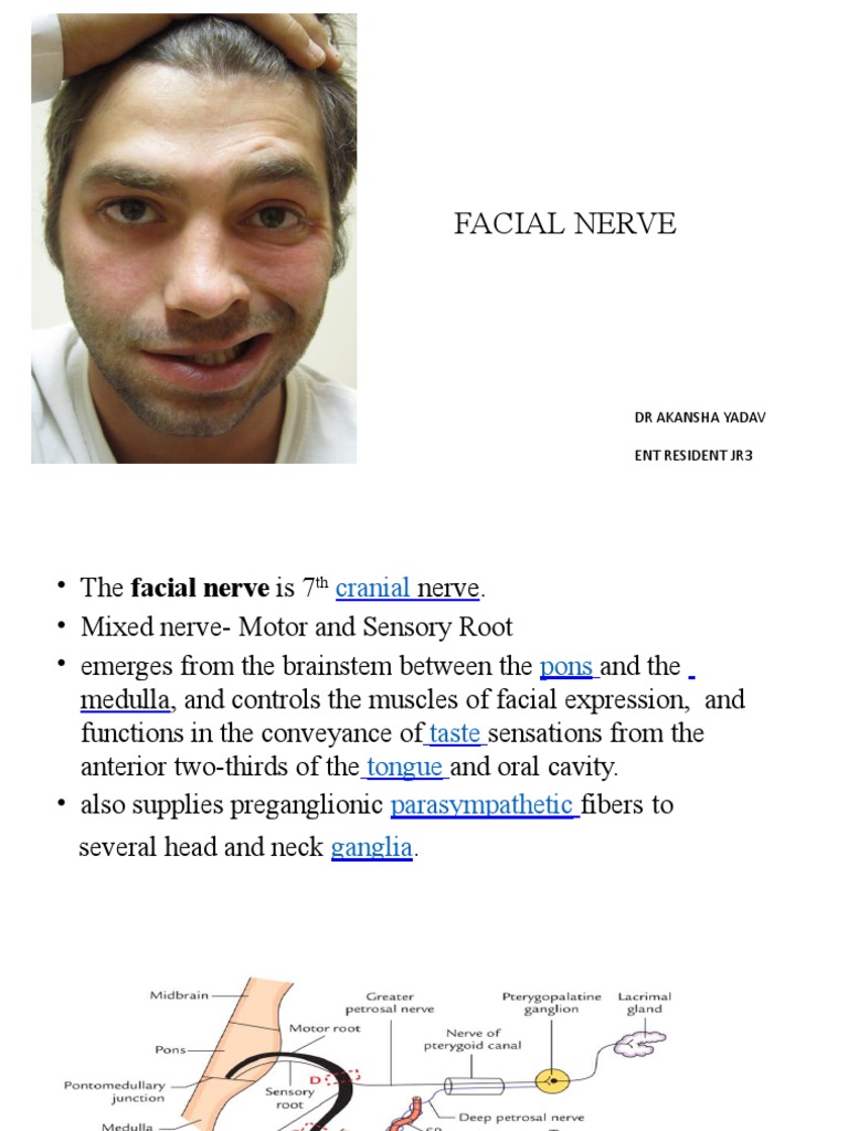 Facial Nerve Palsy: DR Akansha Yadav Ent Resident Jr3 | PDF ...