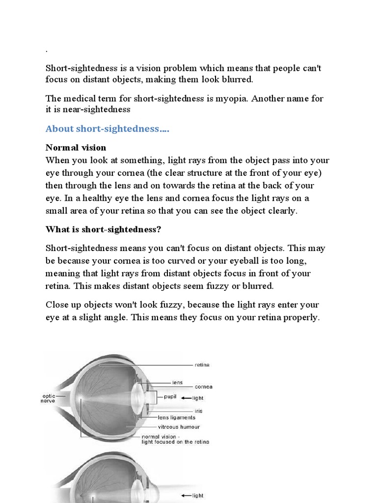 About Short-Sightedness .: Normal Vision | PDF | Electromagnetic ...