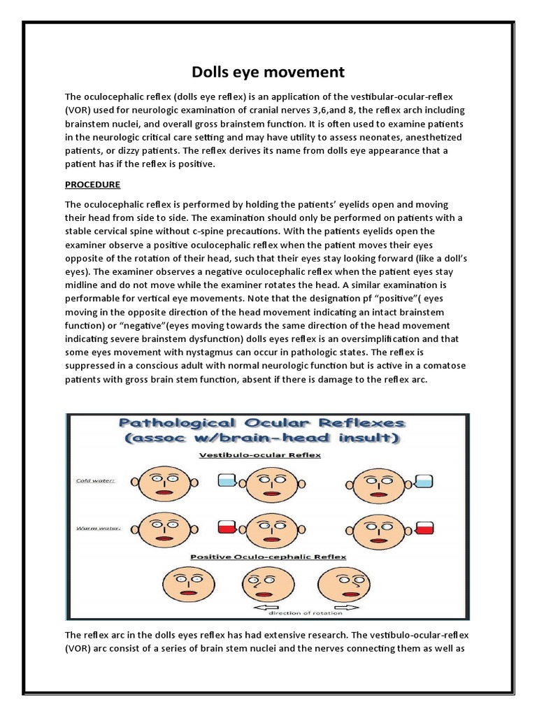 Dolls Eye Movement | PDF | Vestibular System | Nervous System