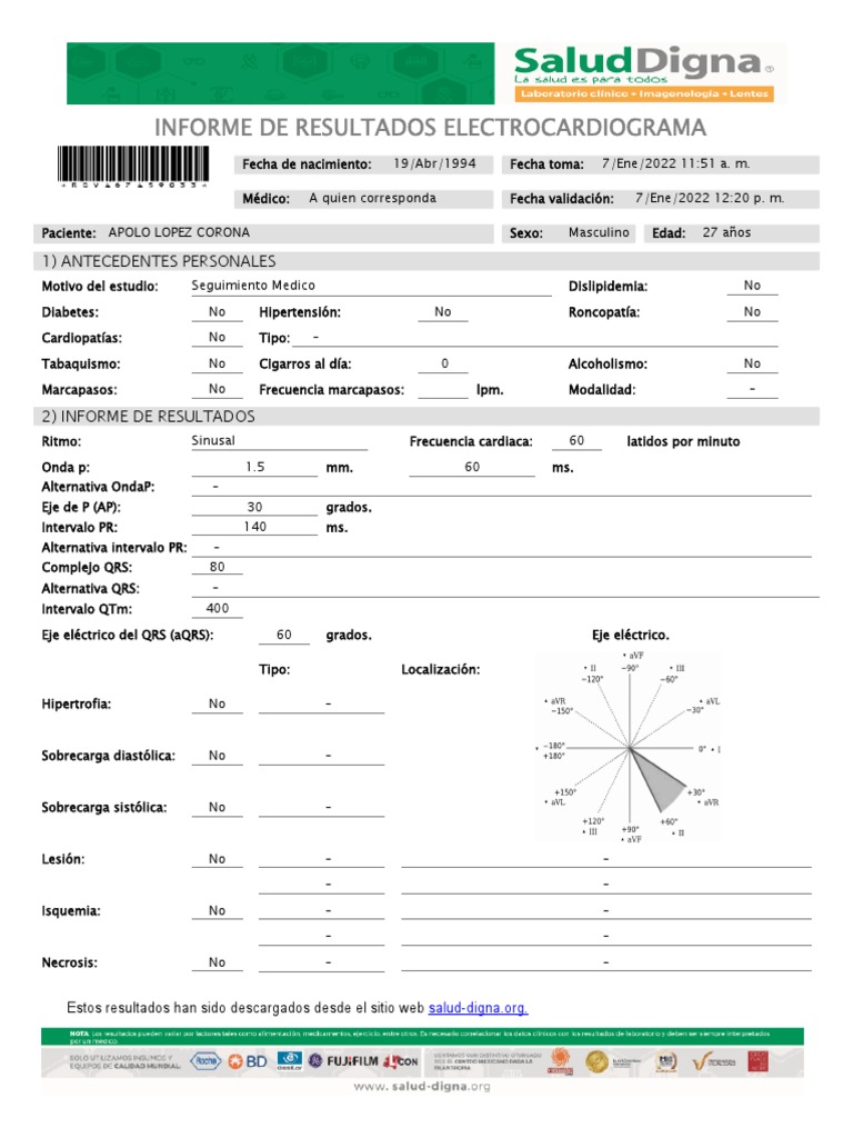 Informe de Electrocardiograma Normal | PDF | Electrocardiografia ...