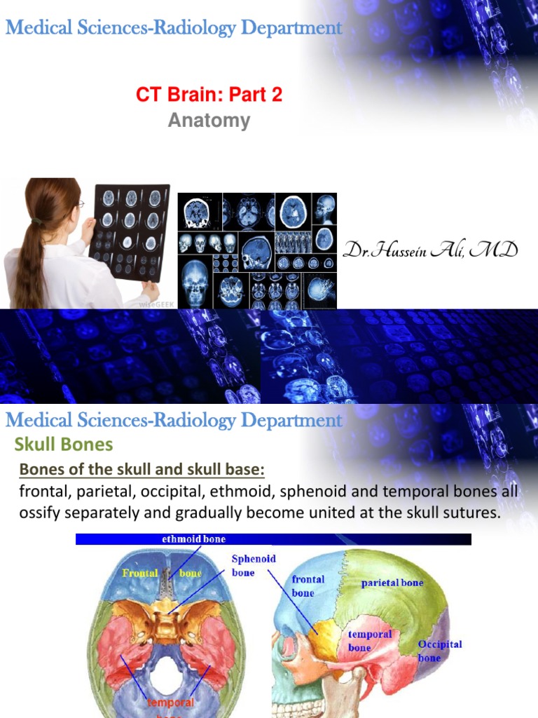 CT Brain Part II-Anatomy | PDF | Skull | Cerebral Cortex