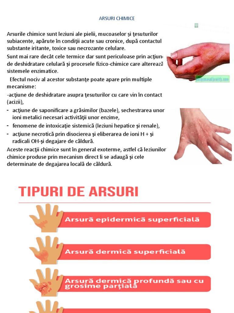Arsuri 2 | PDF