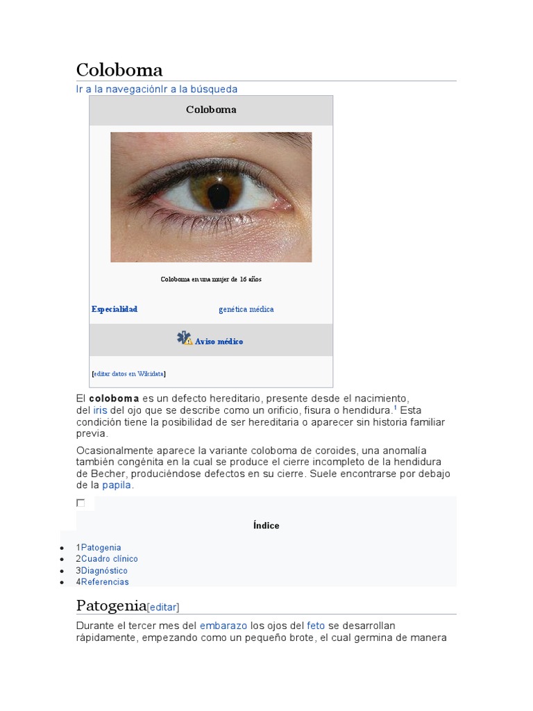 Coloboma 89 | PDF | Especialidades Medicas | Medicina CLINICA