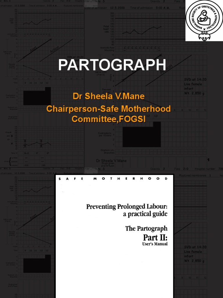 Reducing Maternal Mortality with the Partograph | PDF | Childbirth ...